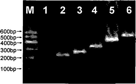 Primer Group And Kit For Synchronously Detecting Multiple Tobacco Viruses Eureka Patsnap
