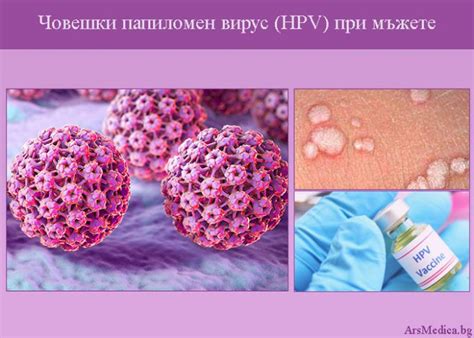 Човешки папиломен вирус Hpv при мъжете Arsmedica Bg