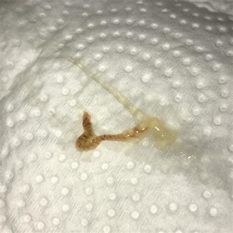 Why Does My Booger Have A Spiral Like That Boogers