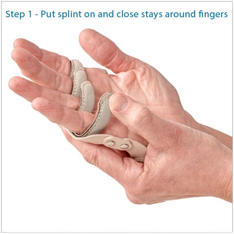 3pp Polycentric Hinged Ulnar Deviation Splint