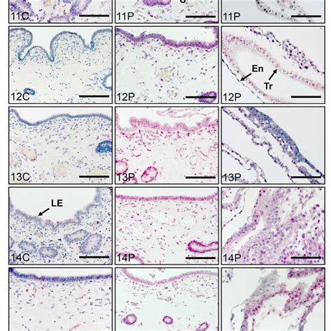 In Situ Hybridization Analyses Of Ramp3 Mrna In Uteri From Cyclic And Download Scientific
