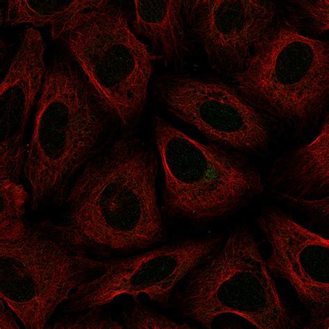Subcellular Cebpa The Human Protein Atlas