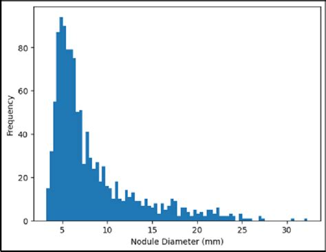 Figure 1 From Automatic Detection Of Lung Nodules In Computed Tomography Images Using U Net
