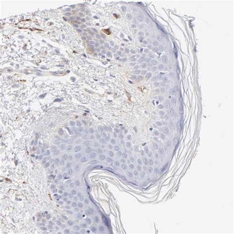 Rabbit Polyclonal Anti Plat Antibody Buy For Research Highly