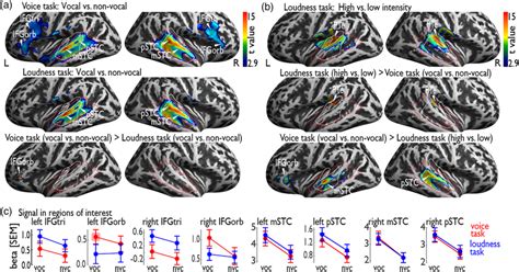 Neural Activation For Vocal And Nonvocal Sound Trials During The Two Download Scientific