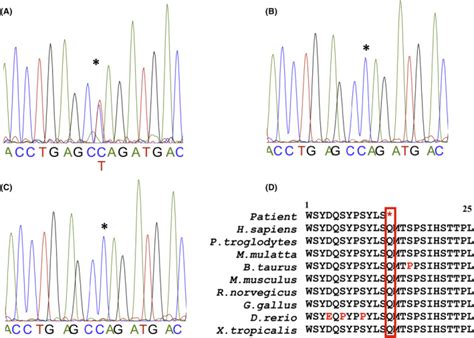 A Novel De Novo Variant In The Runx2 Gene Causes Cleidocranial