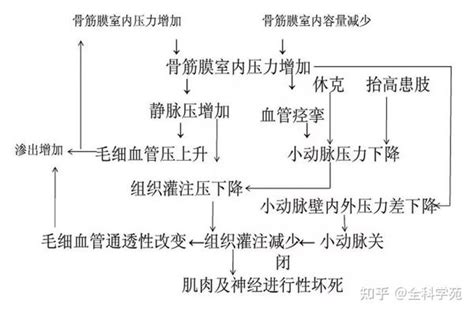 骨筋膜室综合征的紧急处置 知乎