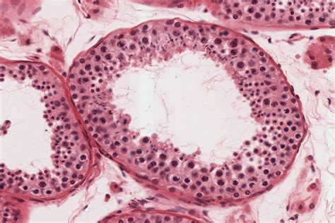 25 Facts About Saprolite