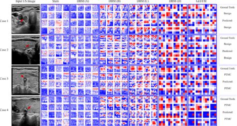 Feature Extraction Path From Four US Images Labeled As Case 14 Each Download Scientific