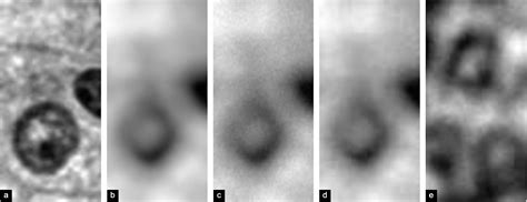 Generating Diverse Synthetic Medical Image Data For Training Machine Learning Models Google