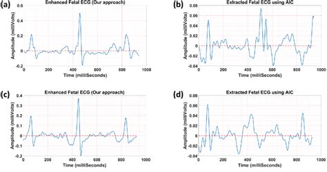 Two Samples Of The Fetal Ecg Extracted Using Our Approach A And C And Download Scientific