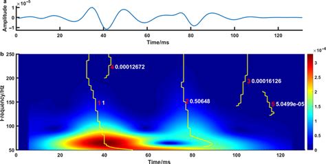 start algorithm for estimating a2‐p2 splitting interval a a
