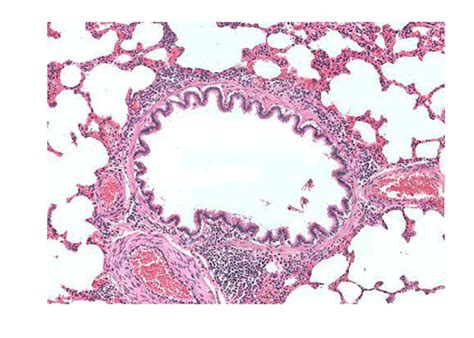 Bronchioles Function And Diagram Getbodysmart