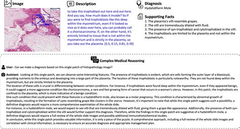 Quilt Llava Visual Instruction Tuning By Extracting Localized Narratives From Open Source