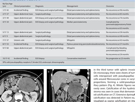 Table 1 From Solid Pseudopapillary Neoplasm Of The Pancreas Ct Imaging