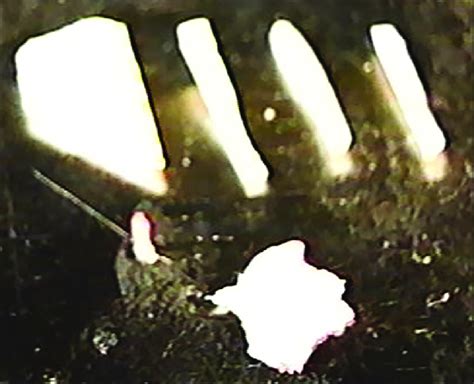 The Tragal Cartilage And Perichondrium Download Scientific Diagram