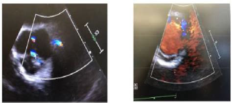 Pre Repair RCA Figure 2 Post Repair RCA Download Scientific Diagram
