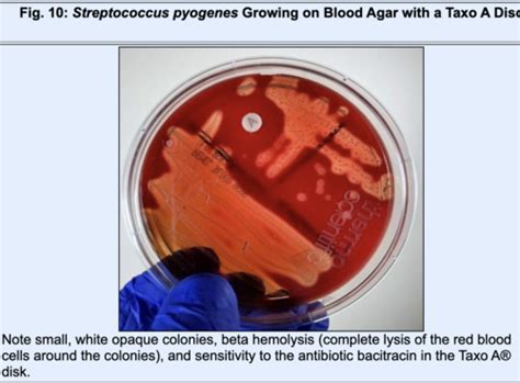 Micro Lab 14 Streptococci And Enterococci Flashcards Quizlet