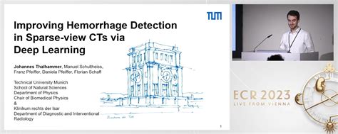 Ai In Stroke And Neurovascular Imaging Esr Connect