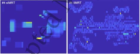 The Fluence Maps Of Simrt And Iimrt For One Of The Tmi Fields
