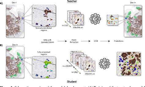 Figure 2 From Semi Supervised Learning To Automate Tumor Bud Detection In Cytokeratin Stained