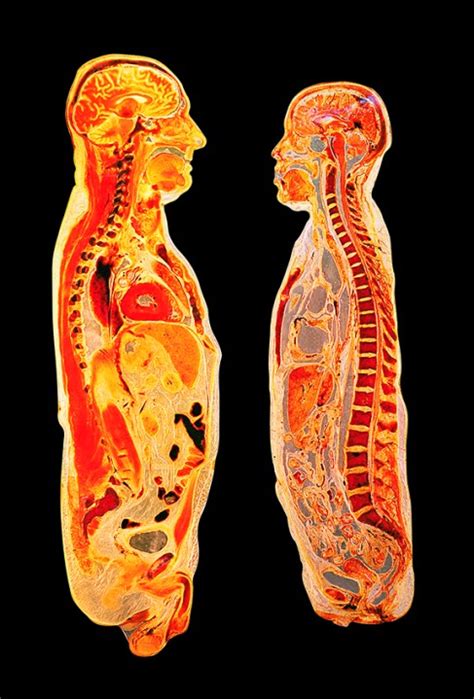 Body Worlds The Anatomy Of Happiness Exhibition Makes Debut At The