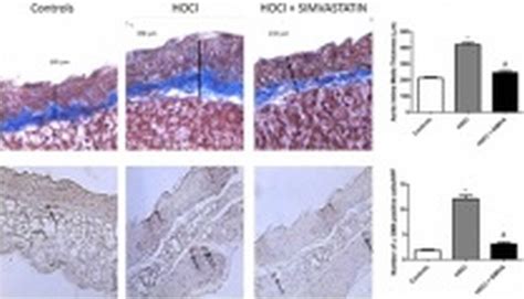 Ab0197 Simvastatin Attenuates Aortic Thickness In The Chronic Reactive Oxygen Species Murine