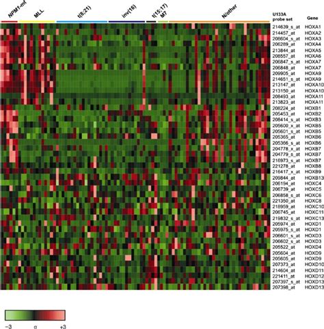 Pediatric Acute Myeloid Leukemia With Npm1 Mutations Is Characterized By A Gene Expression