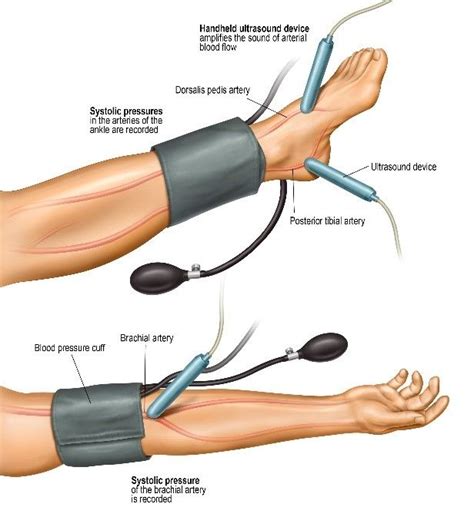 Proper Placement Of Blood Pressure Cuff On Forearm At Dean Metoyer Blog