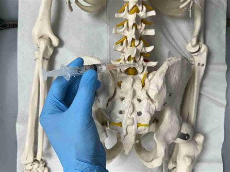 Spinal Injections In Hampshire Ultrasound Guided Spinal Injection