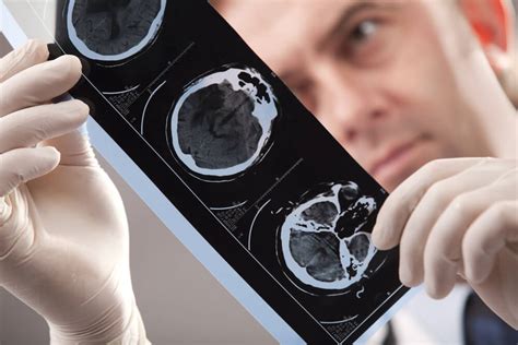 assessing the accuracy of tumour measurements select statistical