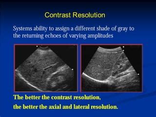 Basic Physics Of Ultrasoundpdf Lecture Of Sonar Pdf