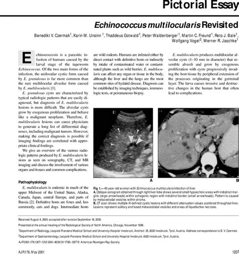 Echinococcus Multilocularis Revisited Ajr