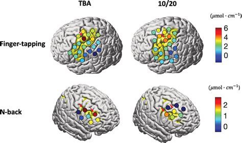 Comparison Of Task Activations Measured By Montages Placed Using Download Scientific Diagram