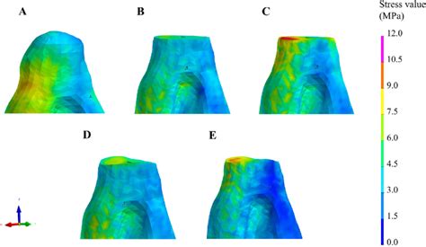 Stress Distribution Pattern At The Root Apex A Nr Model No Download Scientific Diagram