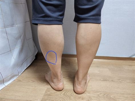 종아리 발 저림통증 지식in