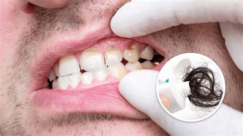 Study Finds Toothpaste Made From Human Hair Could Help Repair Teeth