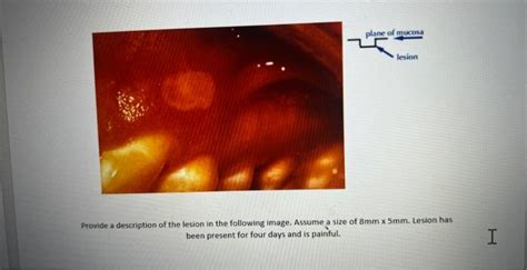 Solved Provide A Description Of The Lesion In The Following