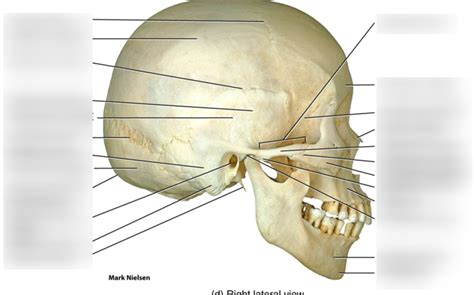 Lateral Skull Diagram Quizlet