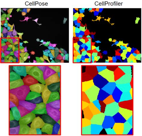 CellPose Vs CellProfiler Segmentation Comparison TK Analytics