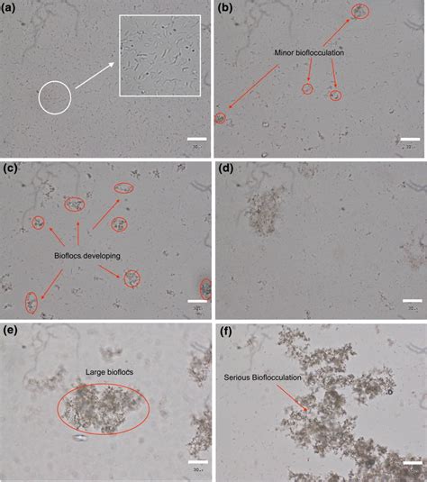 Evolution Of Bacterial Flocs In An Acidified All In One Solution