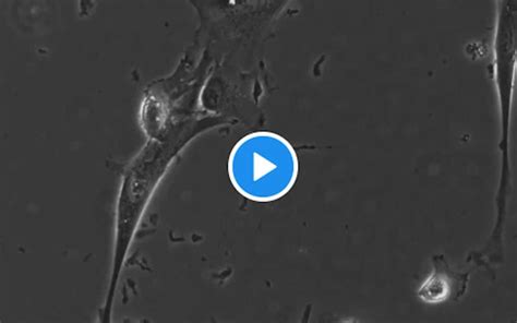 Dr Riordan Shares Video Of Umbilical Cord Tissue Derived Mesenchymal