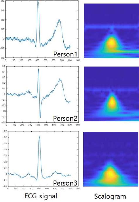 Figure From Performance Comparison For Deep Learning Based Personal Identification From The