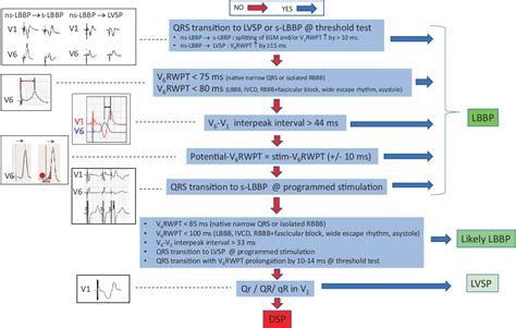 Figure 9 From Current Role Of Conduction System Pacing In Patients