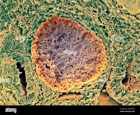 Ovarian Follicle Coloured Scanning Electron Micrograph Sem Of A Fracture Of A Secondary