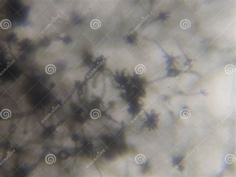 Microscopy Of Trichoderma Viridae Stock Image Image Of Built