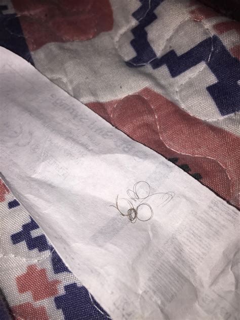 Ive Had An Ingrown Hair On My Pubic Mound For Years And I Finally Got