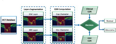 figure 1 from automated glaucoma detection using retinal layers