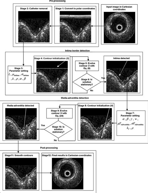 Block Diagram Of Segmentation Algorithm For Border Detection In Ivus