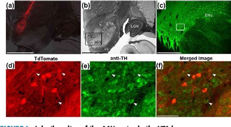 figure 1 from micro led array based photo stimulation devices for